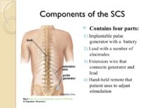 Large Awards Affirmed in Ankle Fracture RSD Case | New York Injury ...